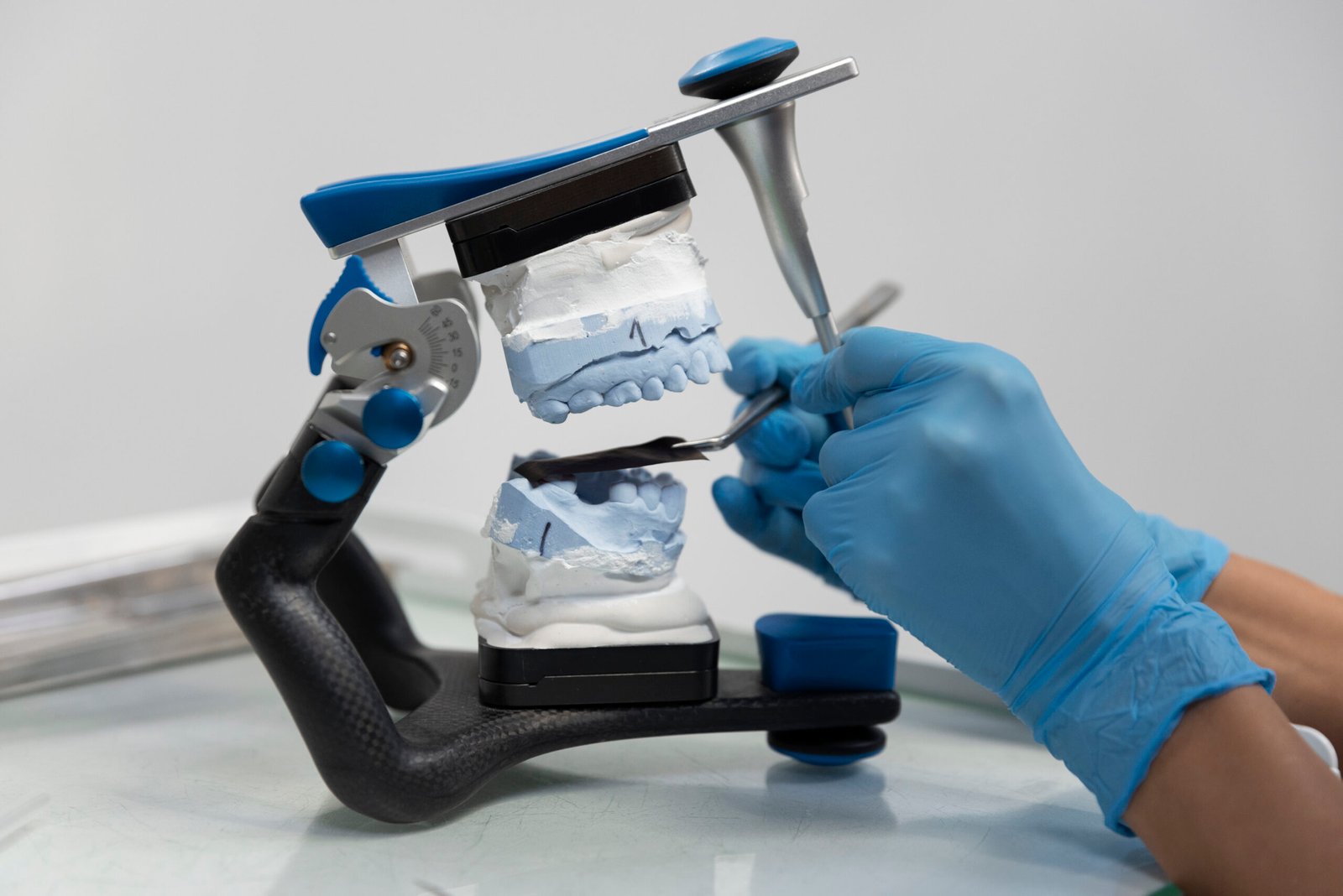 A Succinct Guide to Implant Replacements - Copper Chips